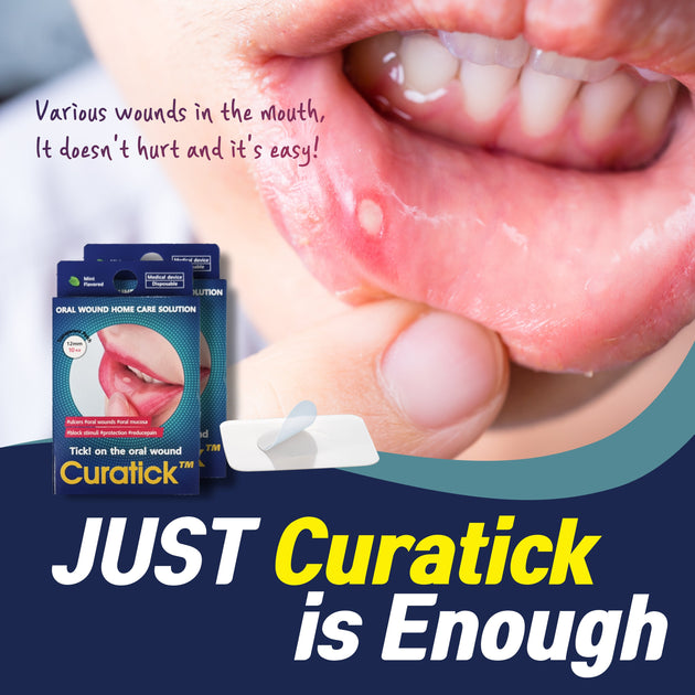 Mouth Ulcer & Canker Sore Relief in the UK – Curatick’s Innovative Ora